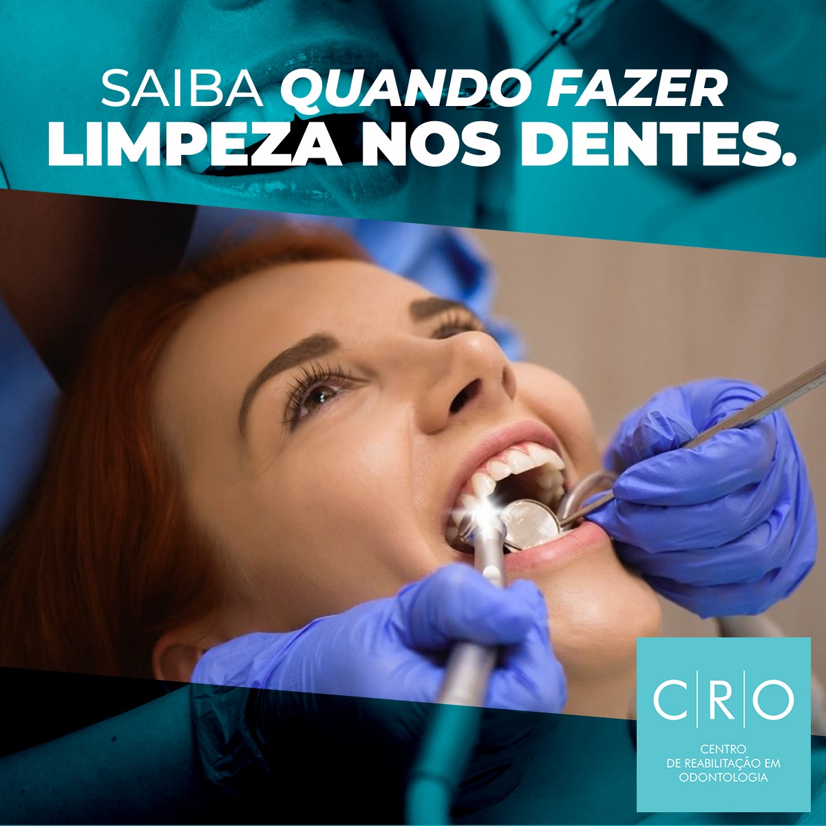 Dentes limpos – CRO-Odontologia